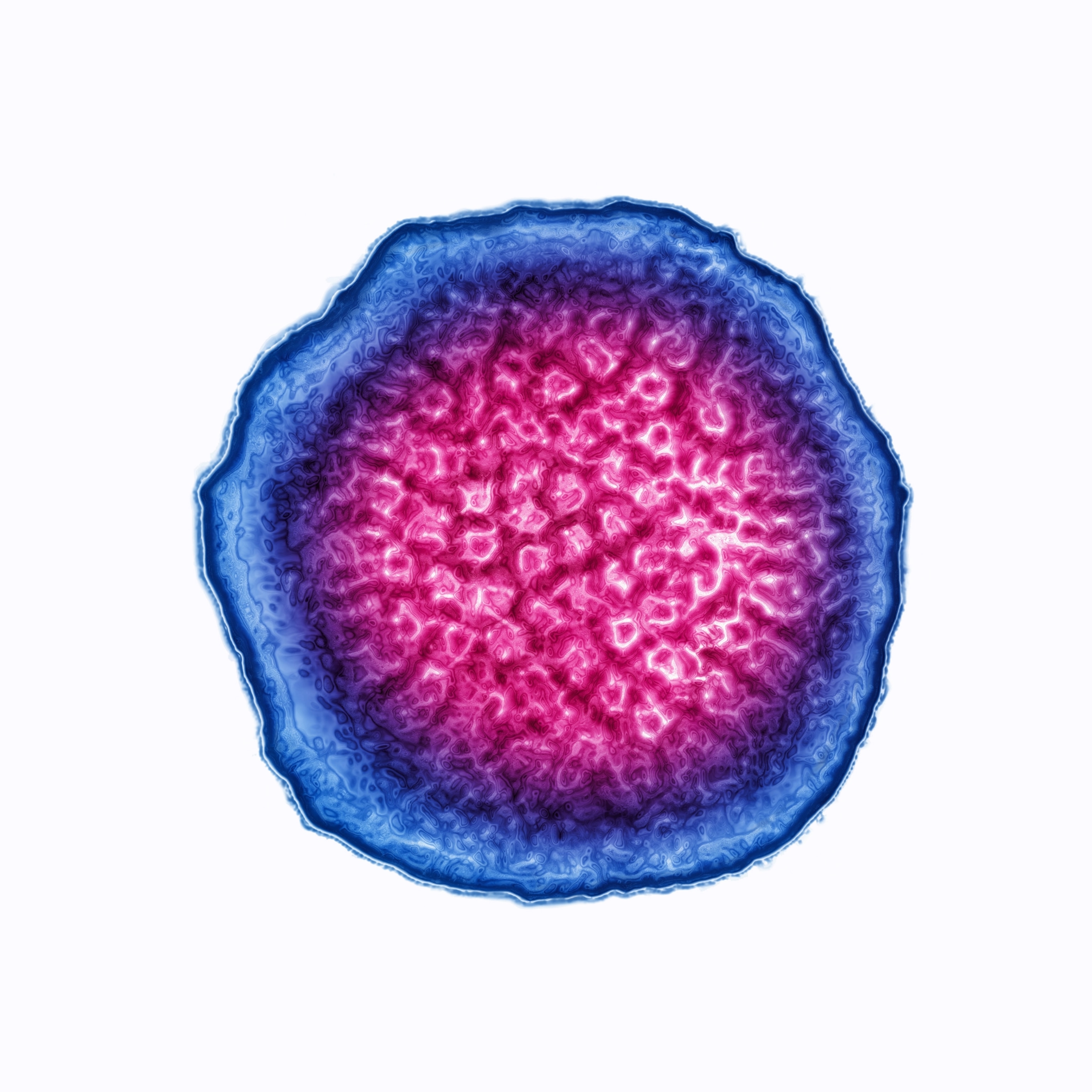 This virus infects almost everyone—and it may lead to lupus | National Geographic