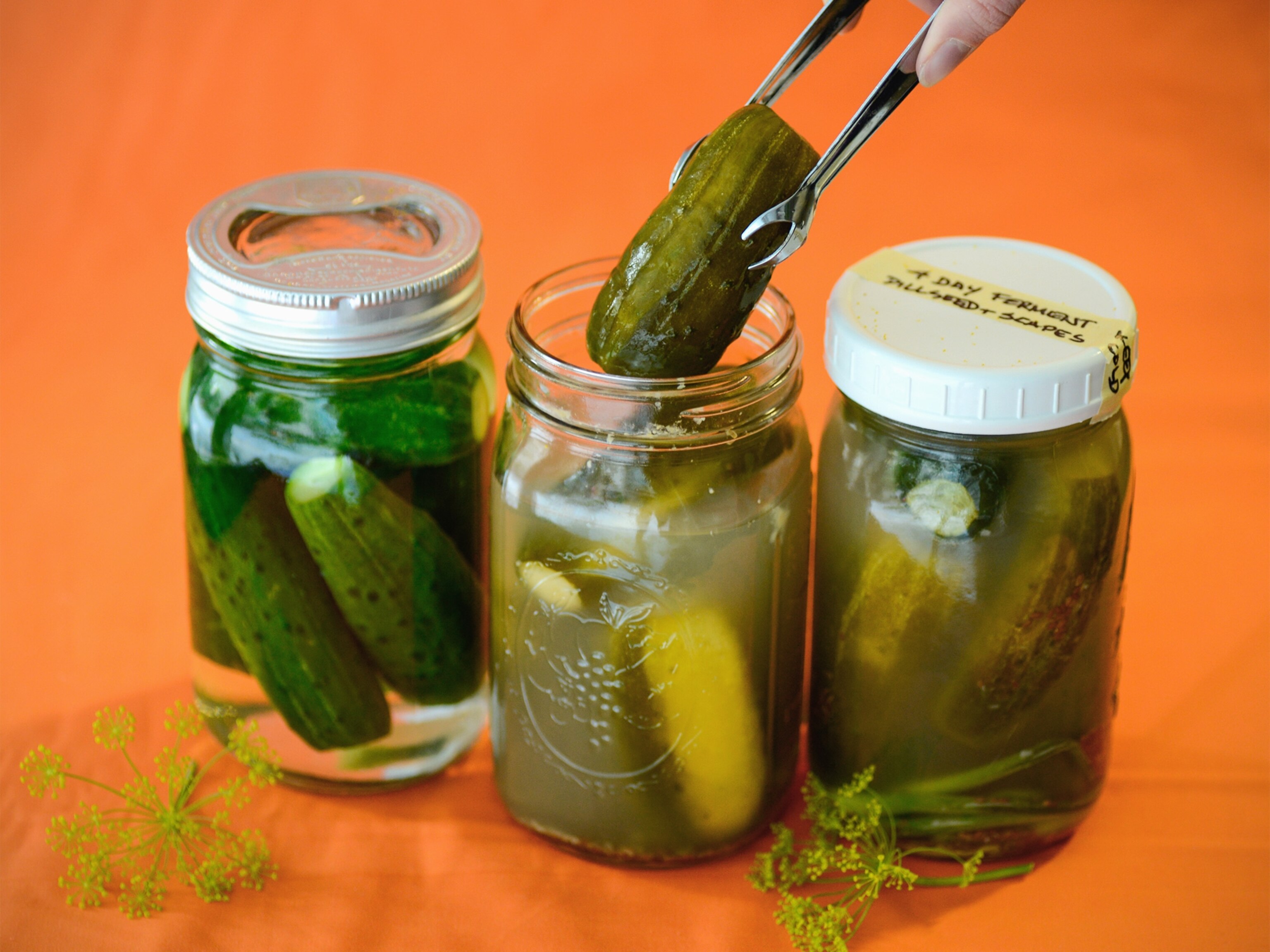 What’s Up With the Bacteria In Your Gut?