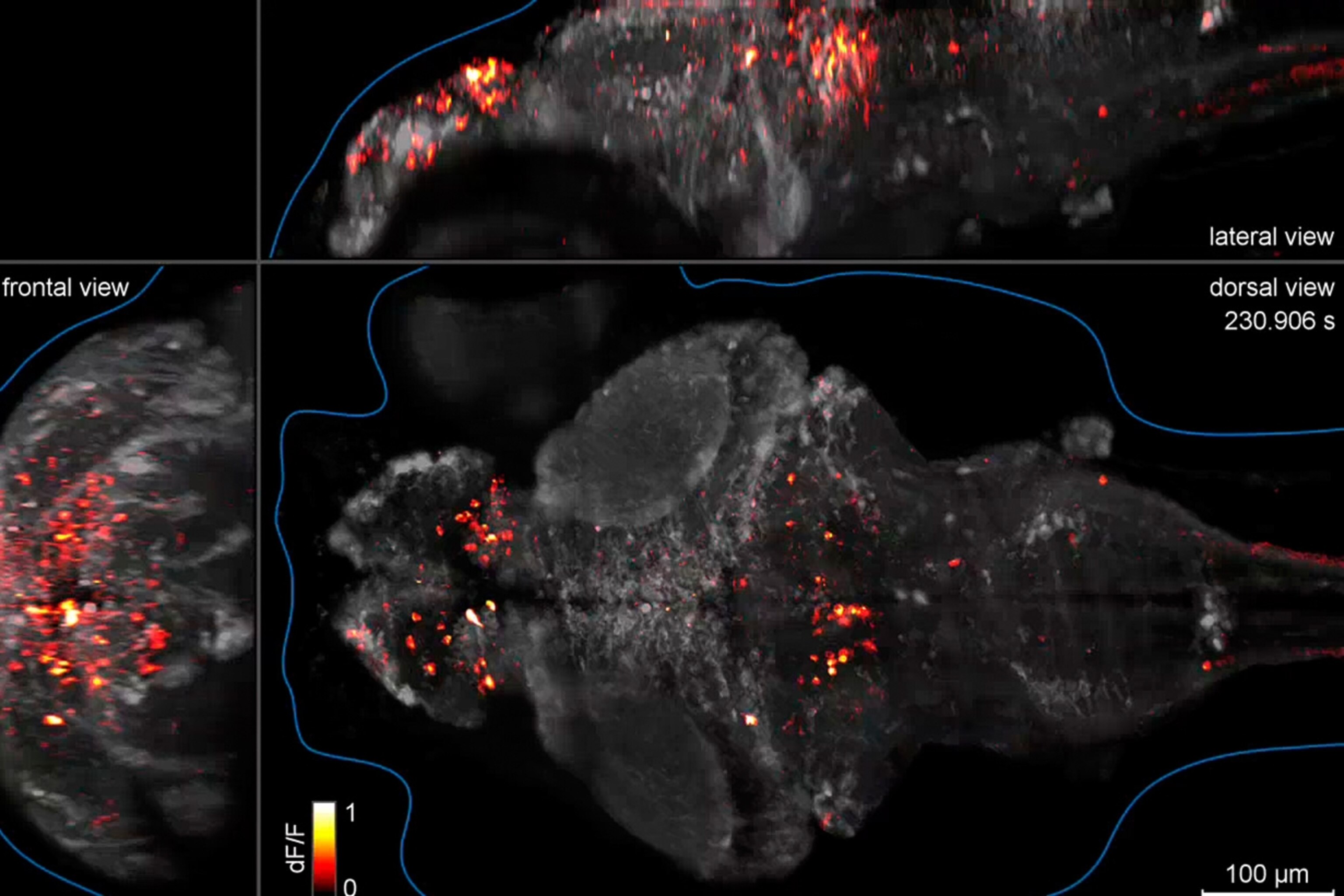 Secrets of the Brain