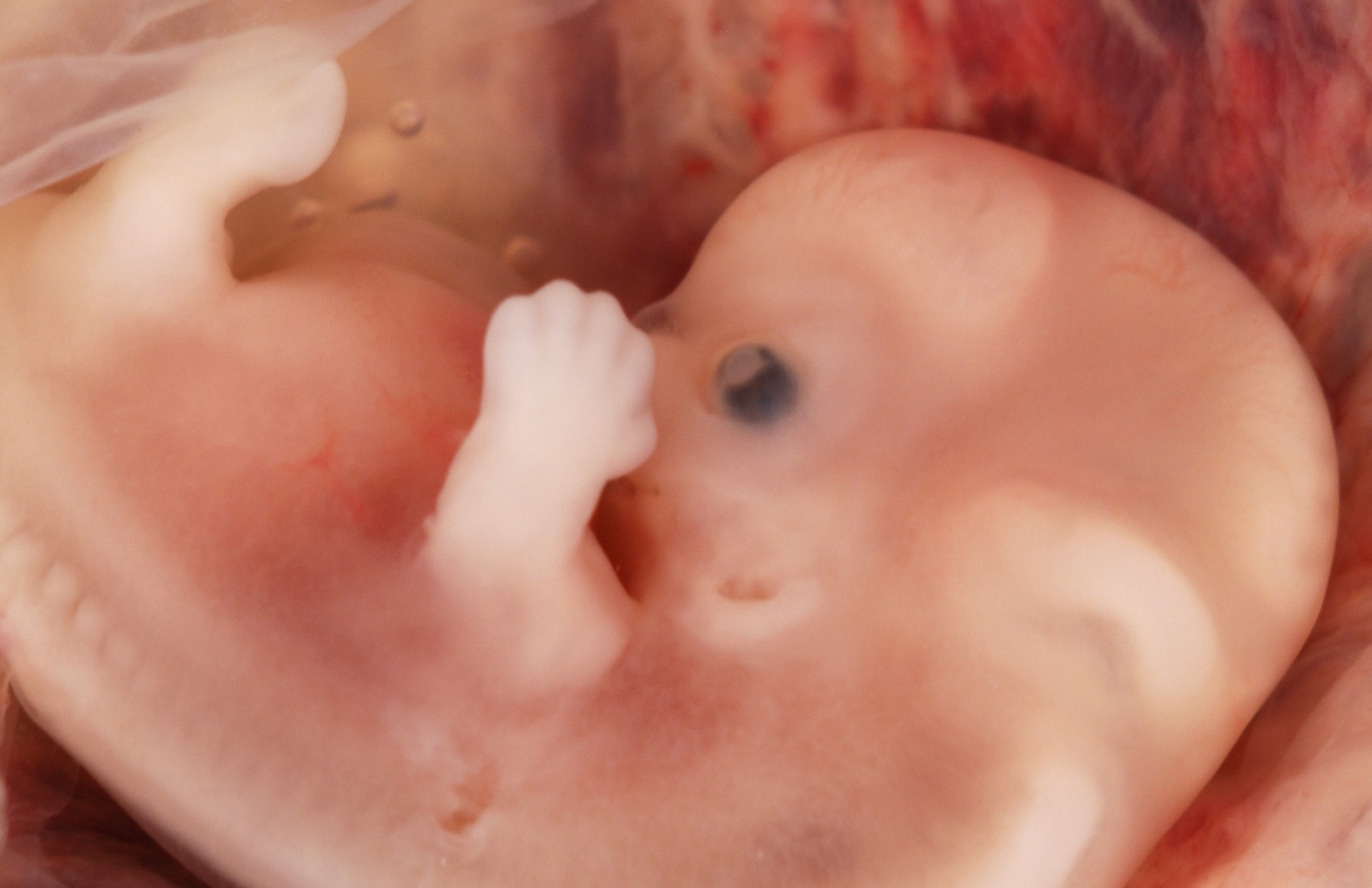 Good Germs In the Womb: My New “Matter” Column in the New York Times on ...