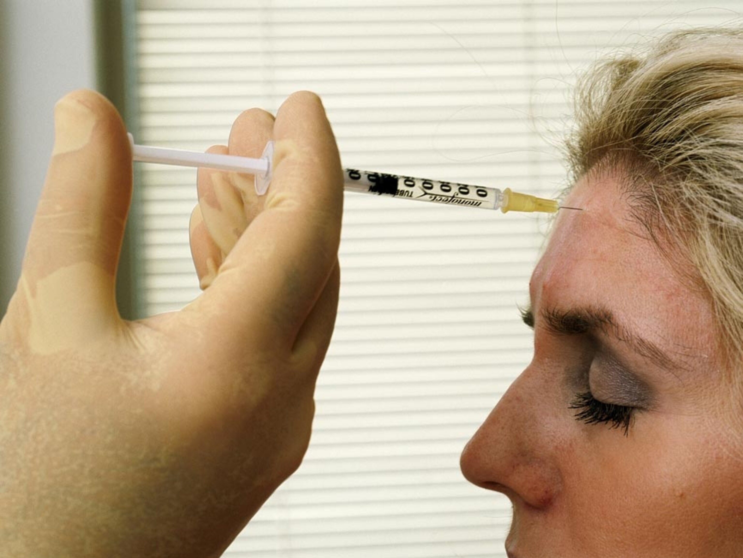 Skin Information and Facts | National Geographic