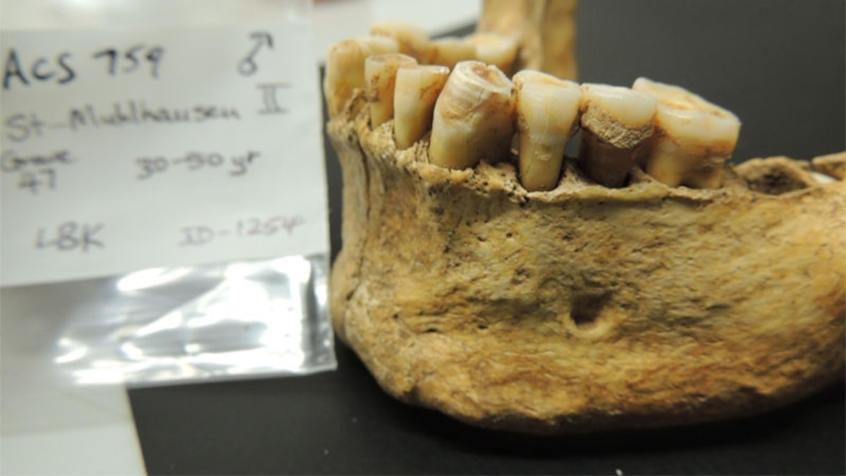 Prehistoric Plaque and the Gentrification of Europe’s Mouth | National ...