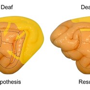 Deaf People
