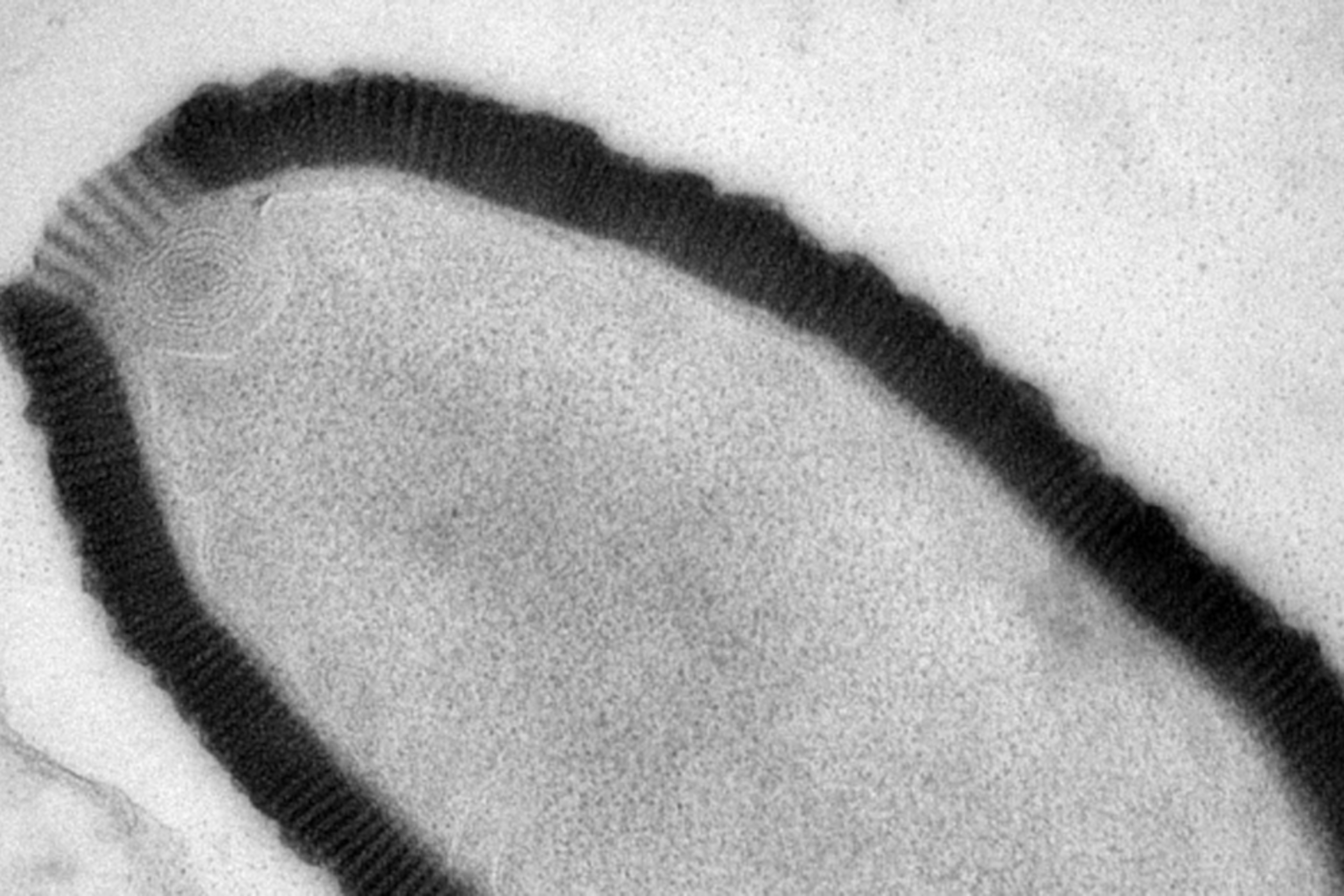 Biggest Known Virus Resurrected From 30,000-Year-Old Ice