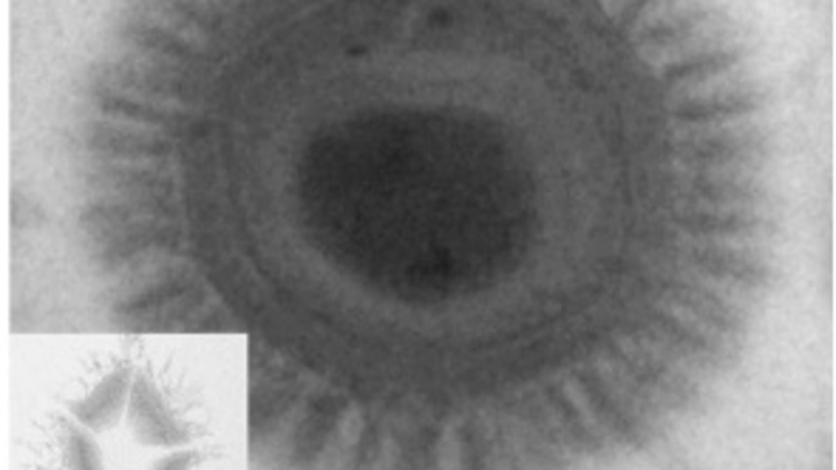 Please welcome Megavirus, the world's most ginormous virus | National ...