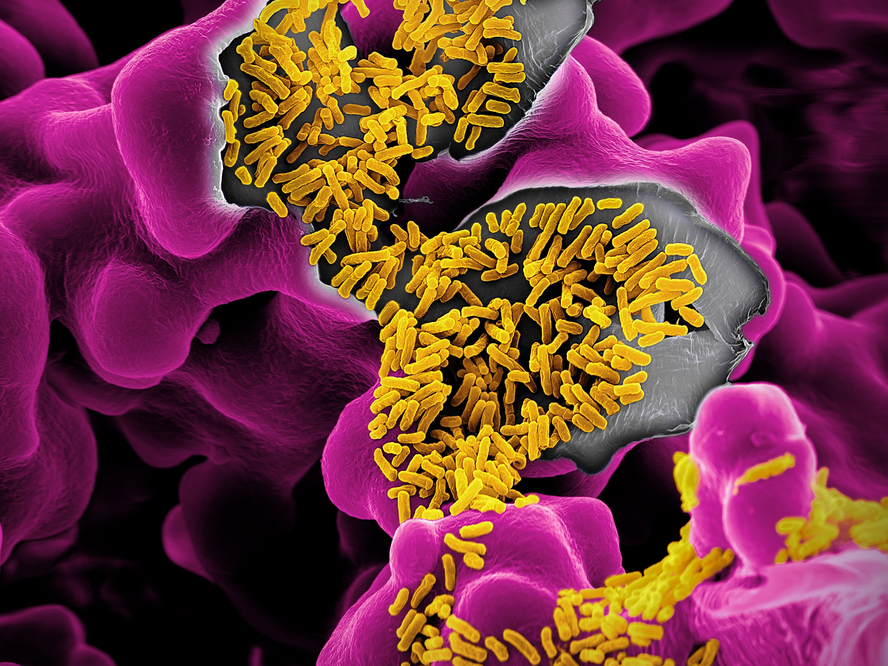 Microbes in your gut may be new recruits in the fight against viruses