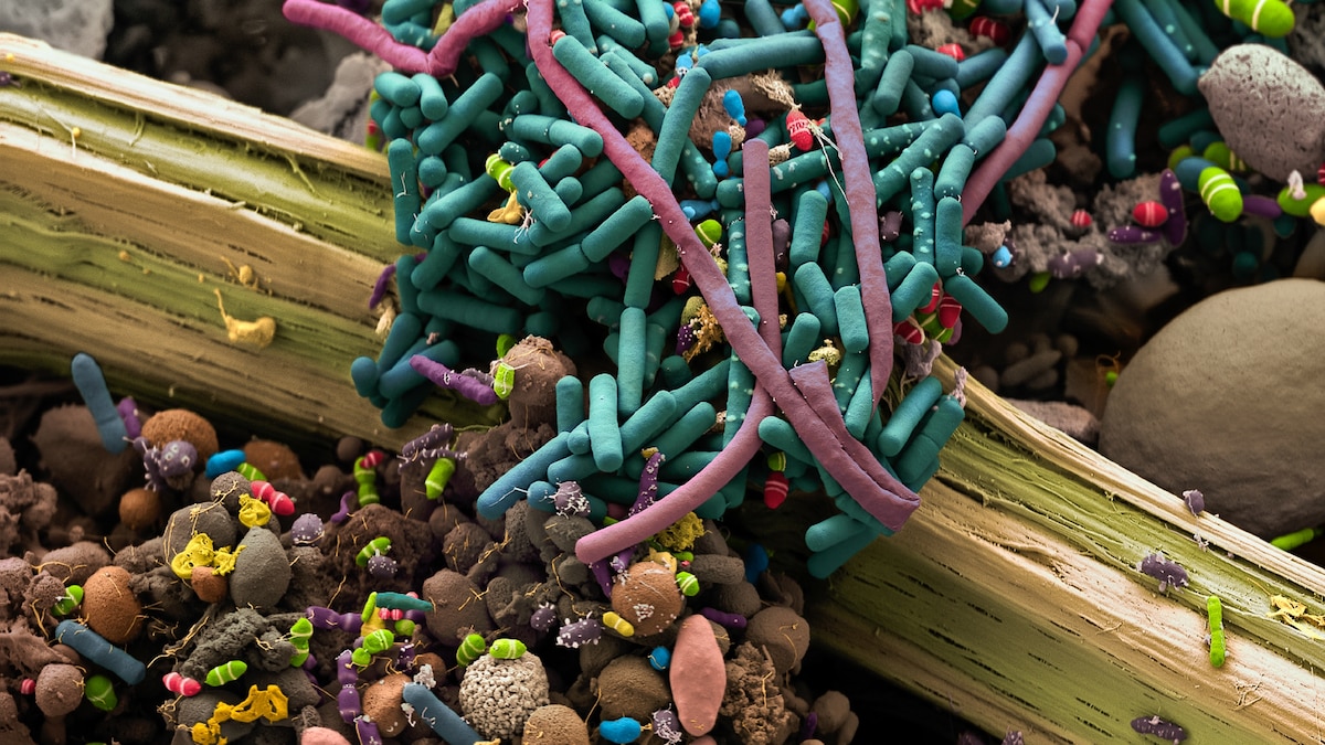 Q&A: Scientist Studied His Poop for a Year to Learn About Gut Bugs ...