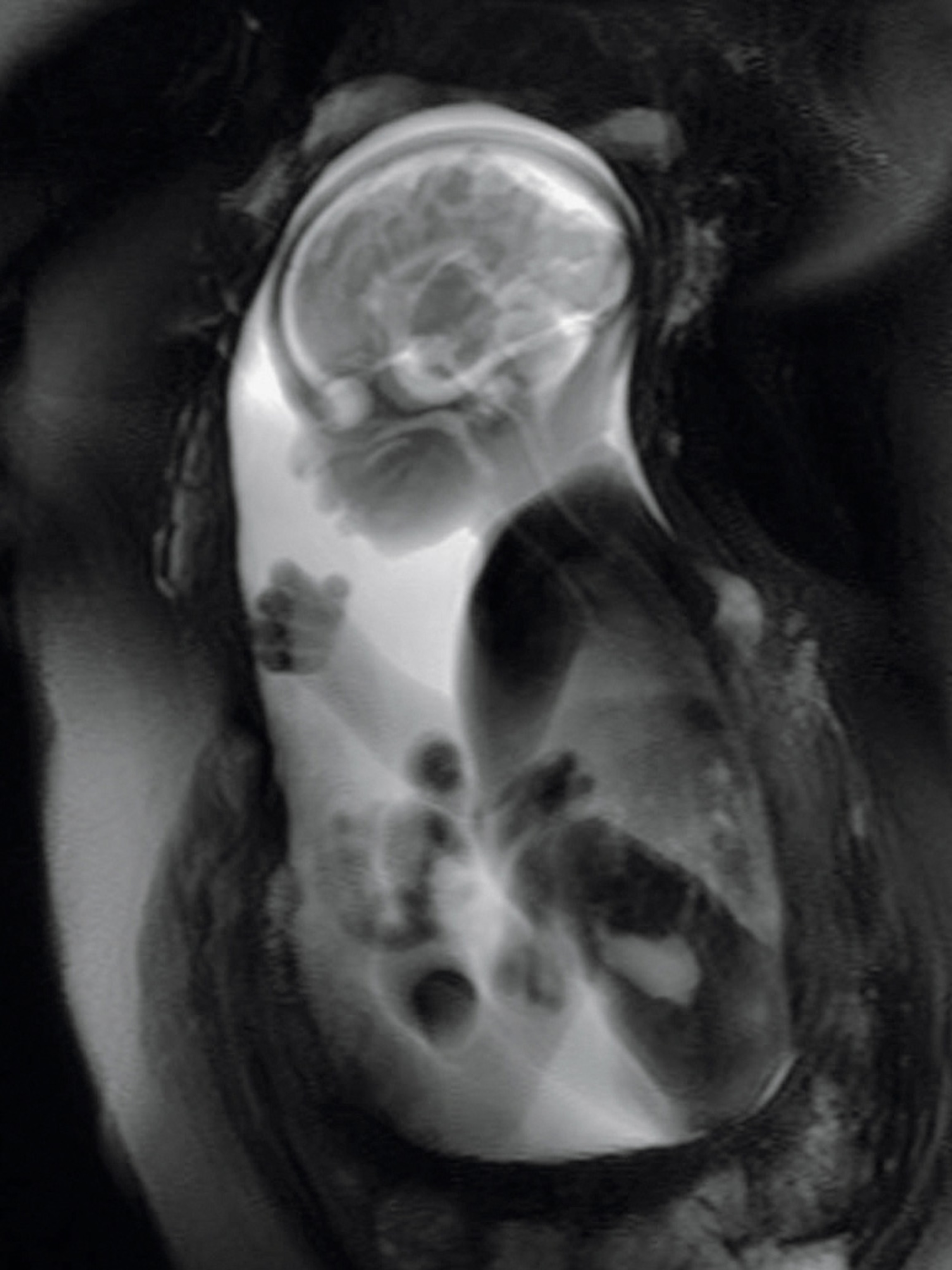 On The Medical Horizon: Mapping the Brain In Utero