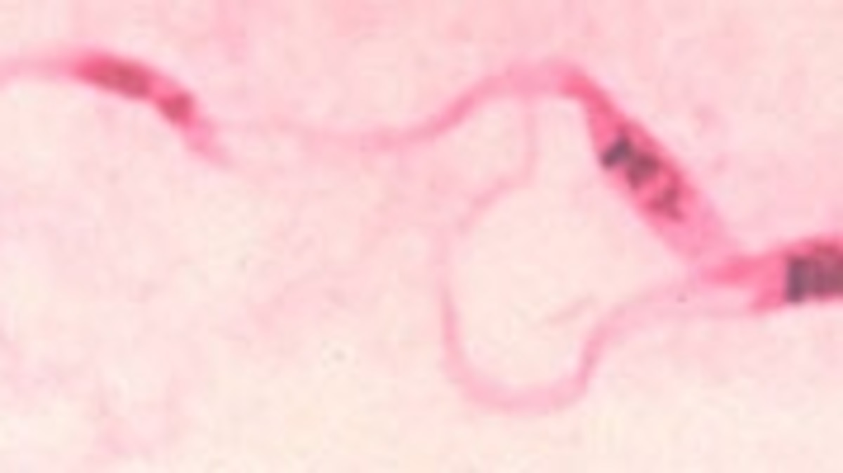 Genes from Chagas parasite can transfer to humans and be passed on to ...