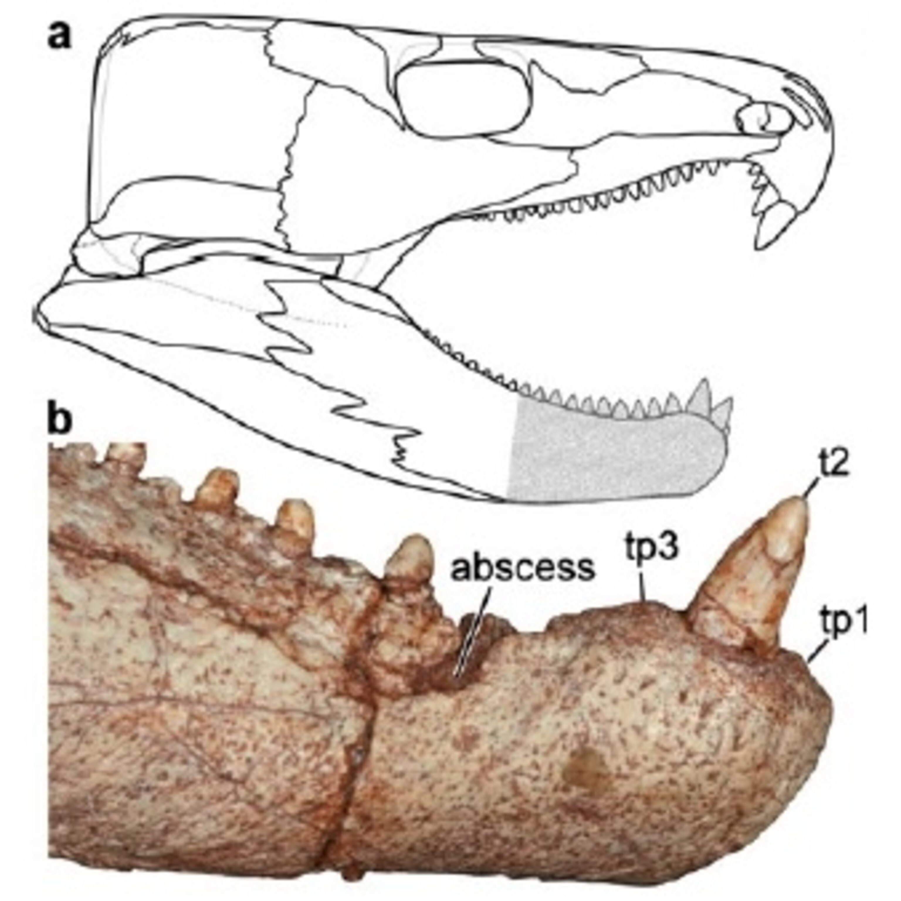 The Oldest Toothache