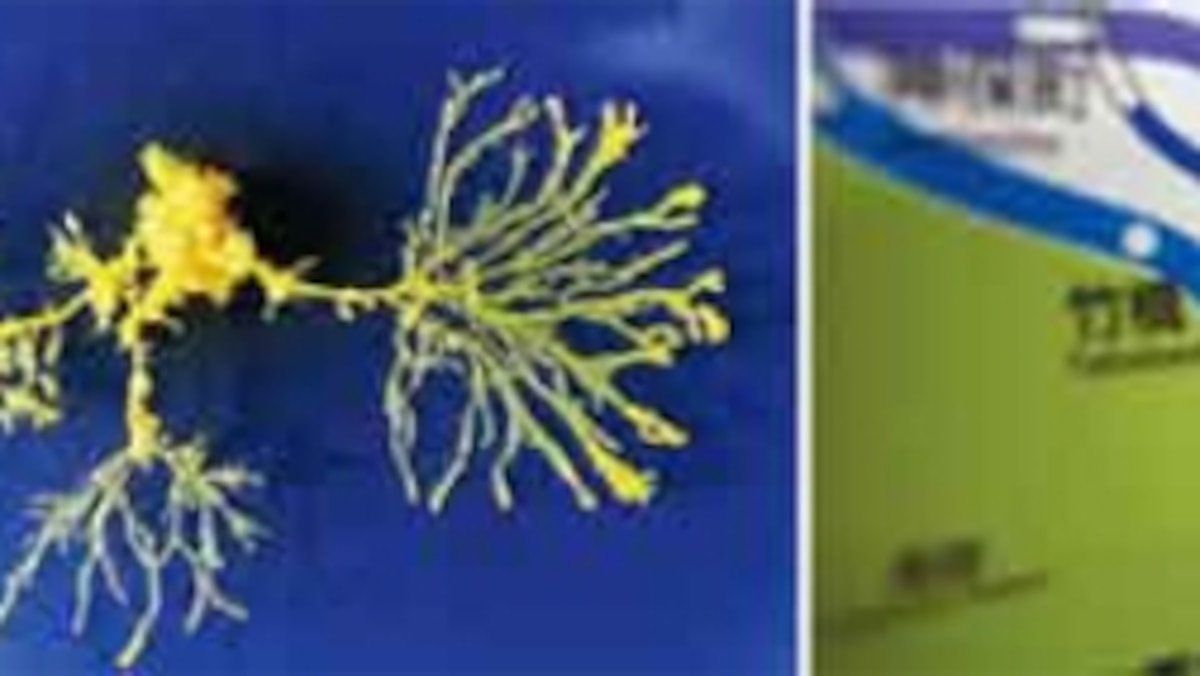 Slime mould attacks simulates Tokyo rail network | National Geographic