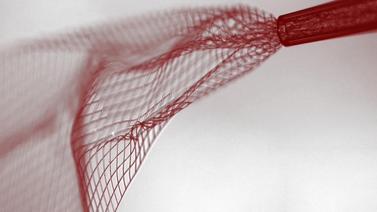 Injecting Electronics Into Brain Not as Freaky as it Sounds | National ...