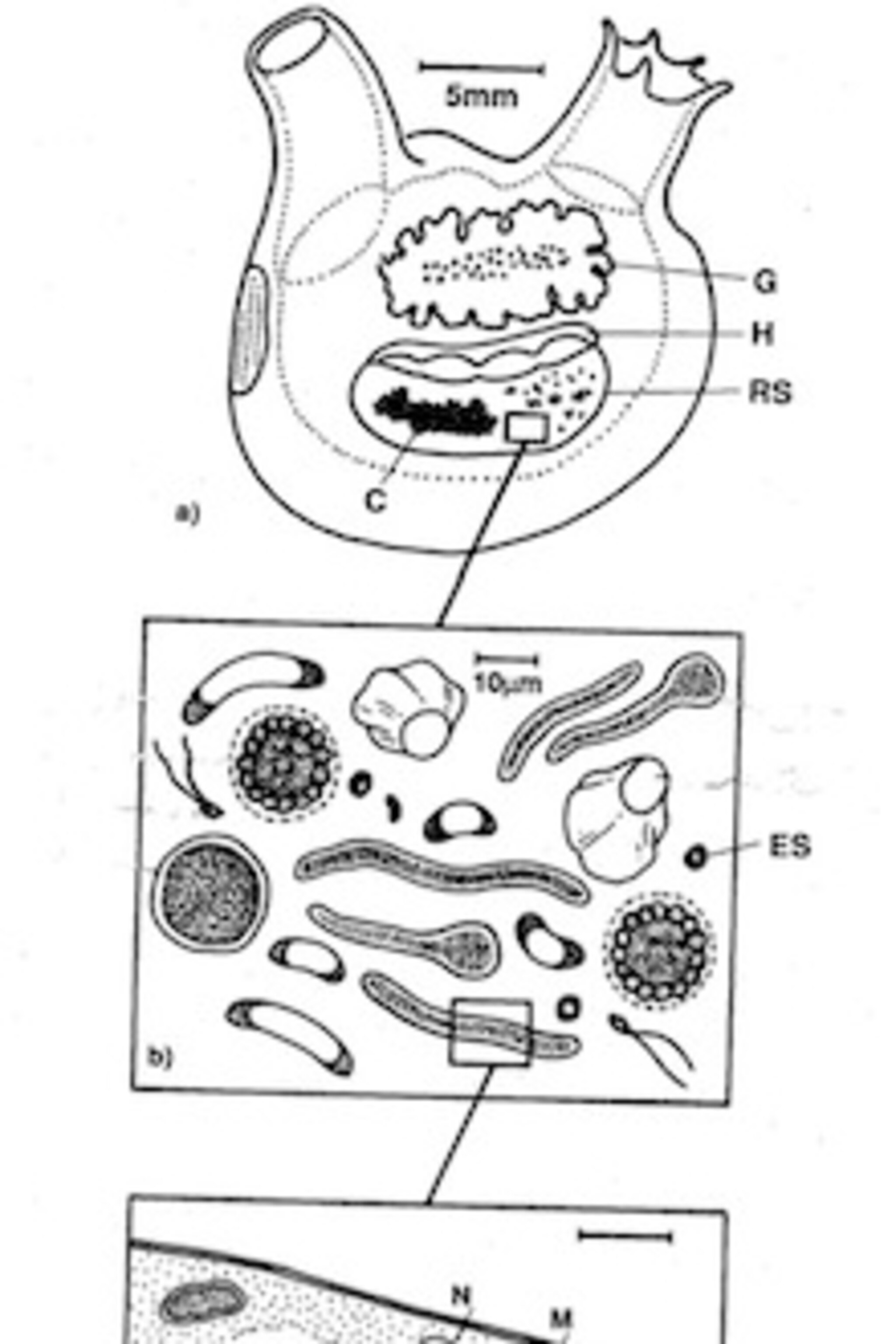 Malaria, Sea Grapes, and Kidney Stones: A Tale of Parasites Lost