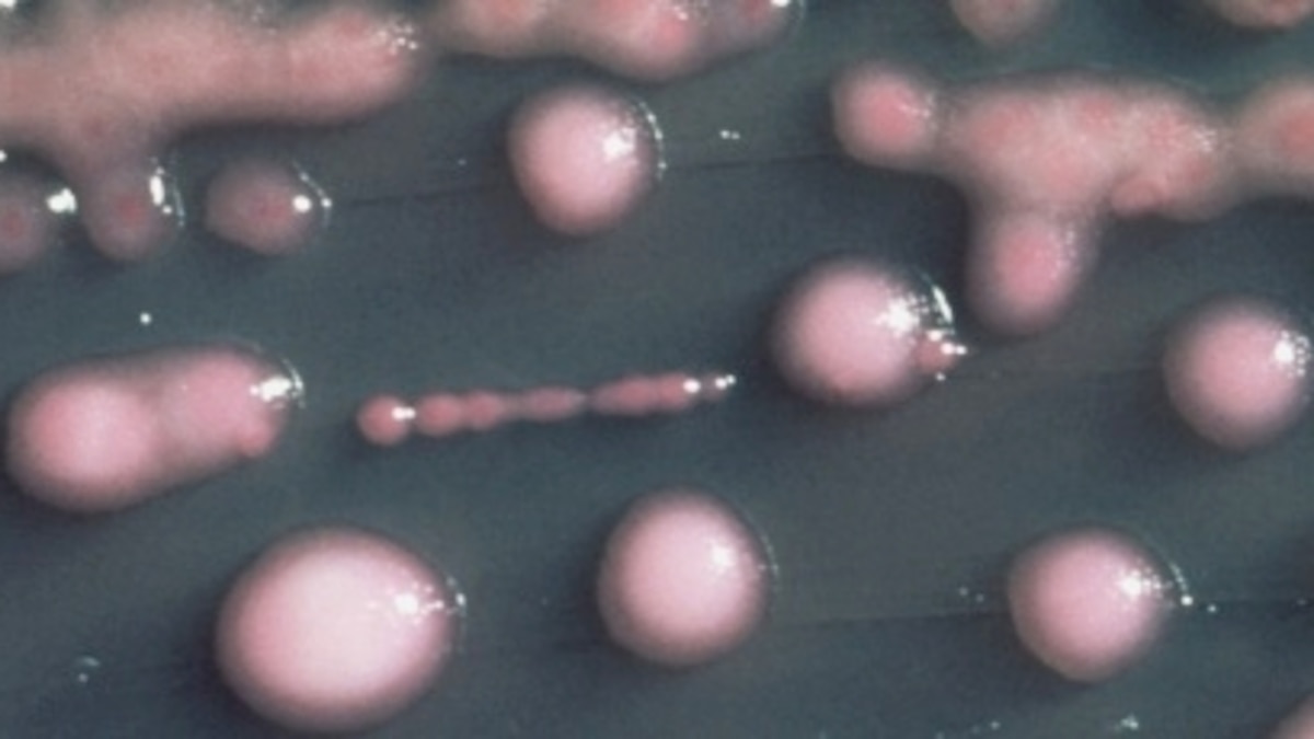 The “Nightmare Bacteria”: An Explainer | National Geographic