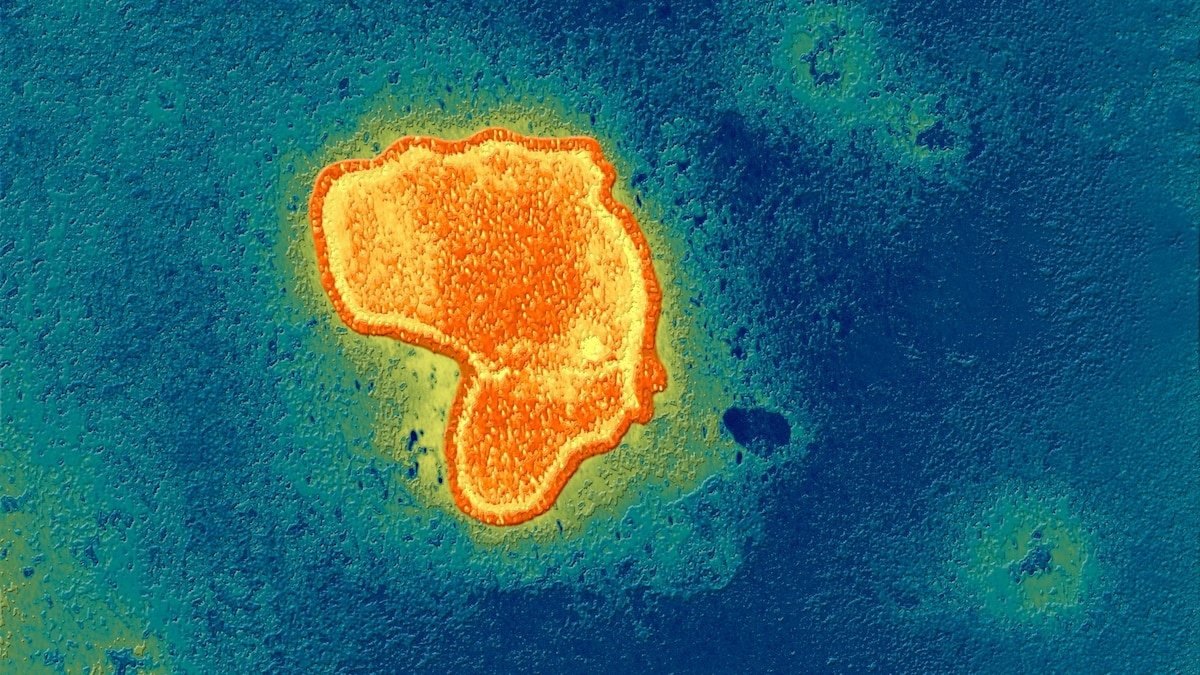 RSV vaccines and preventive drugs have arrived. Which one is right for ...