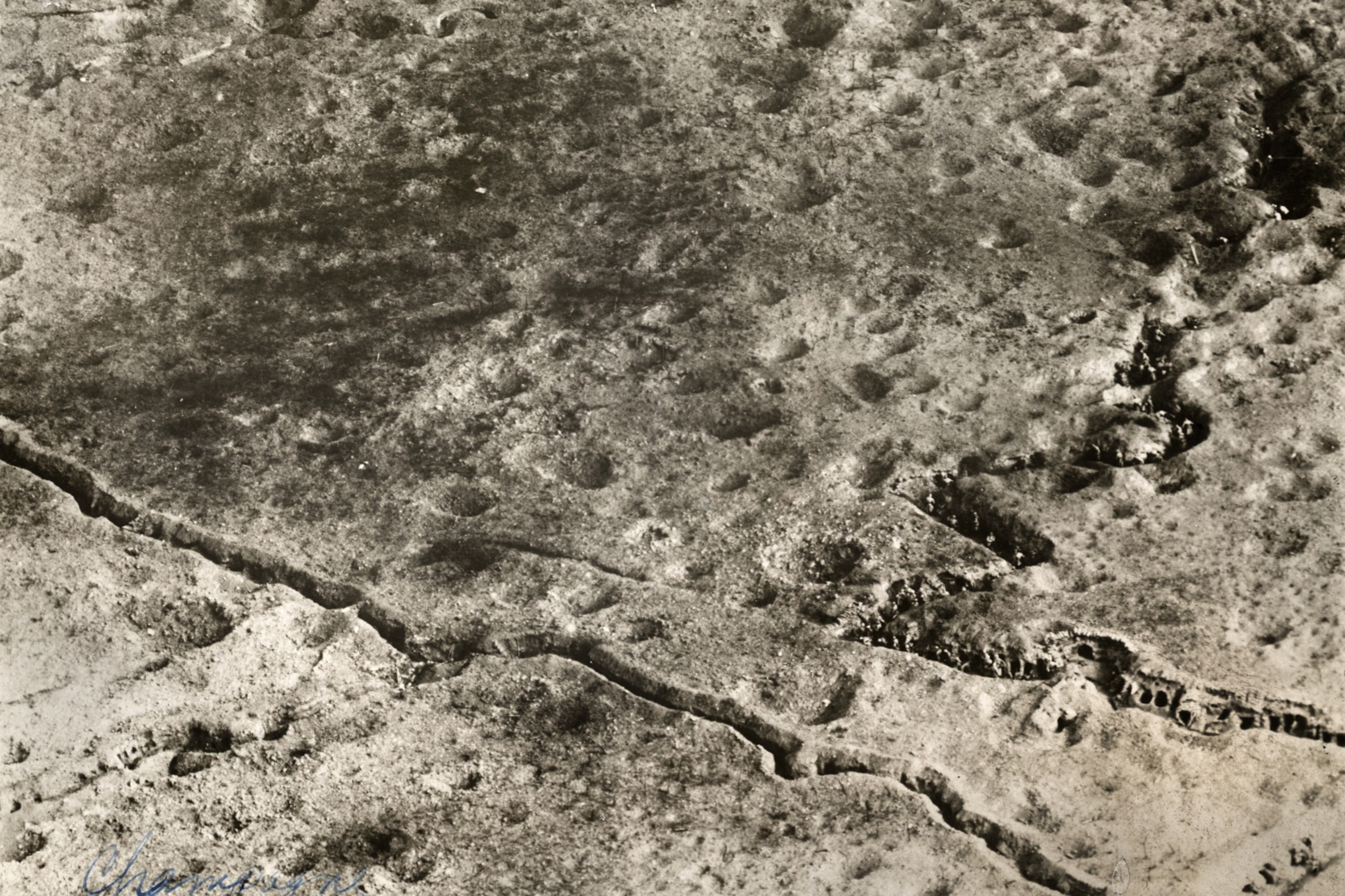 'Shell Shock'—The 100-Year Mystery May Now Be Solved