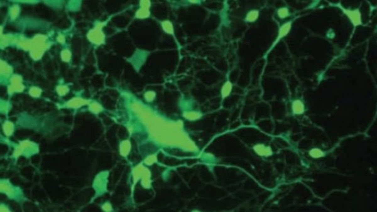Scientists transform skin cells directly into neurons | National Geographic