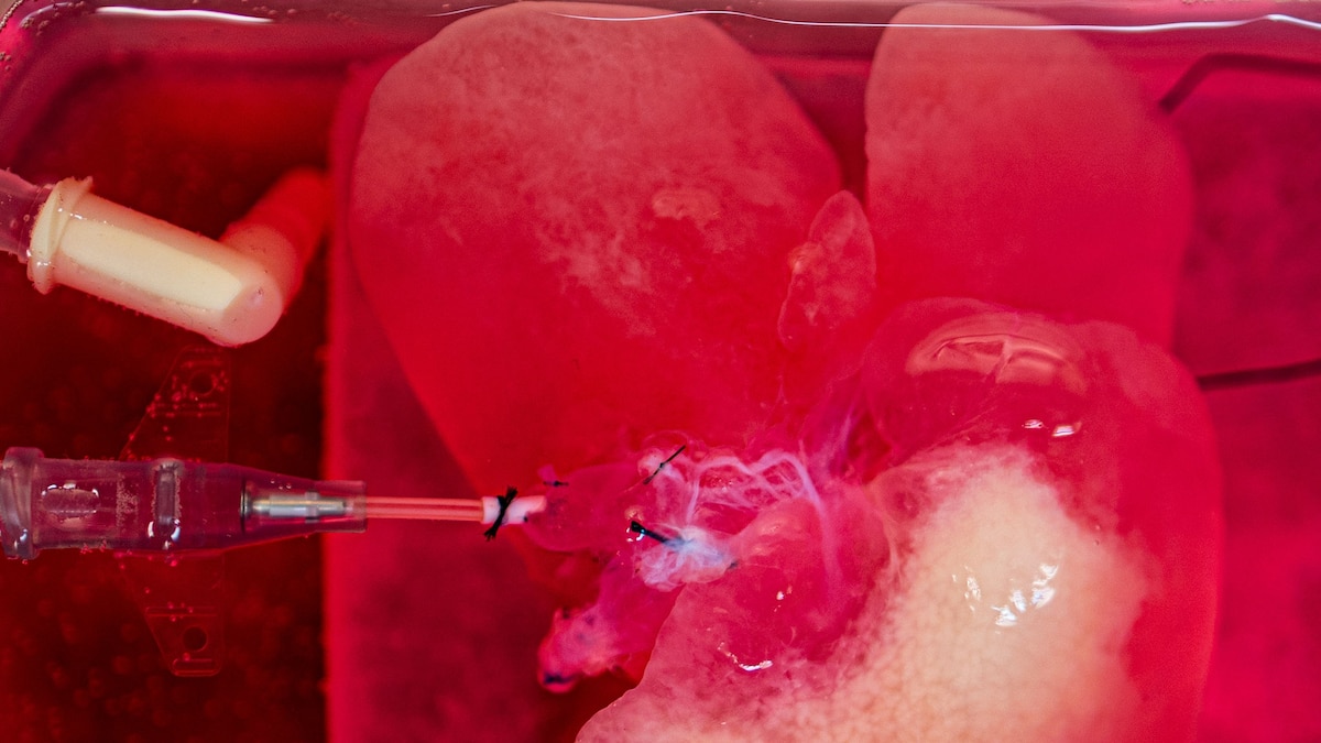 Tiny liver grown in the lab. Here's what it can teach us. | National ...