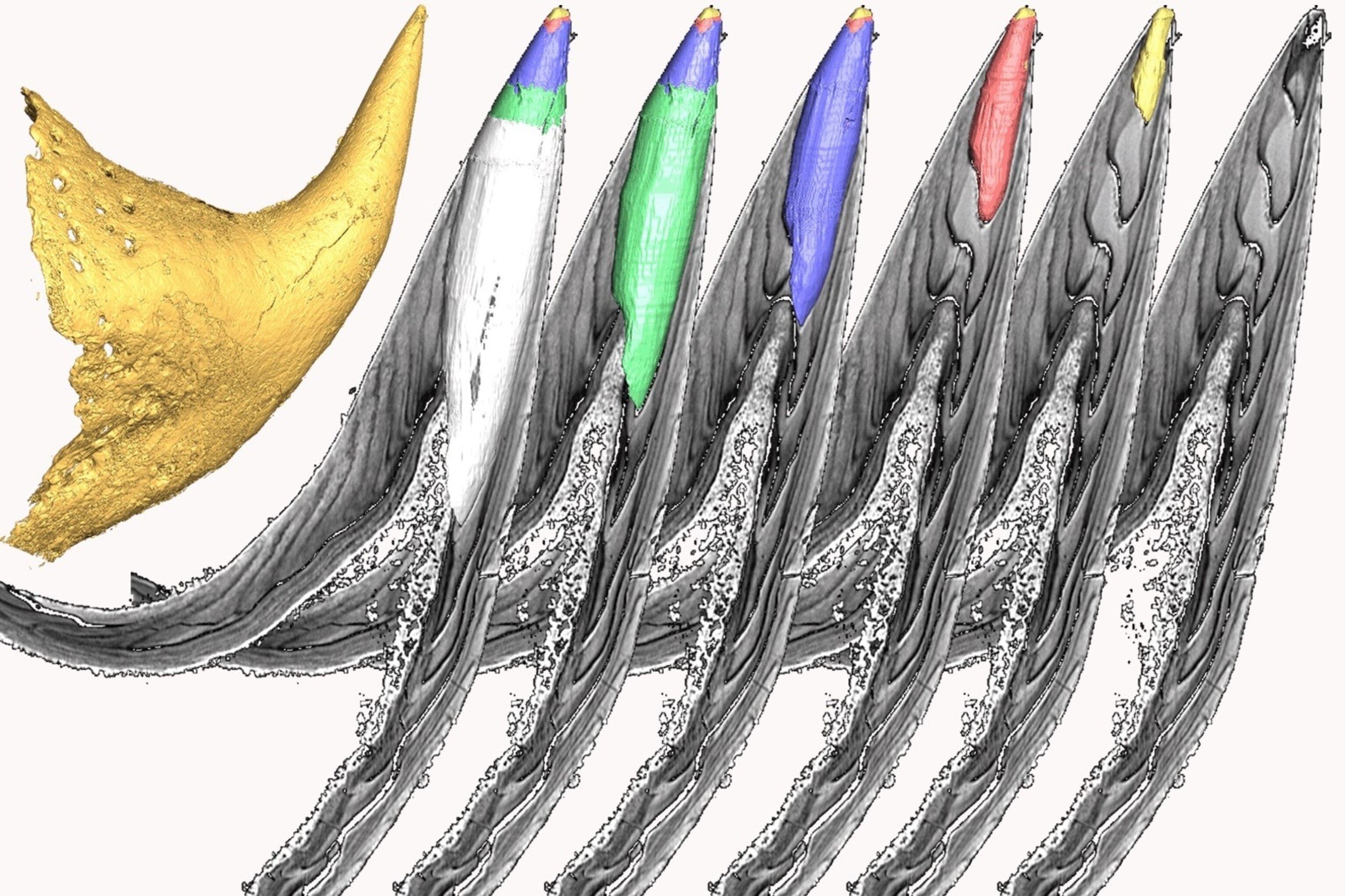 Outside-In Origin For Your Teeth