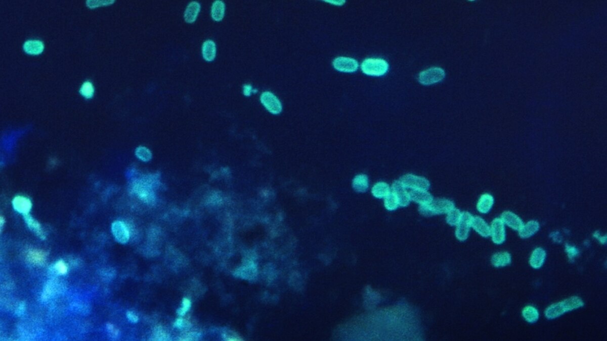 Food Poisoning: An Untrackable Illness In A Globalized World | National ...