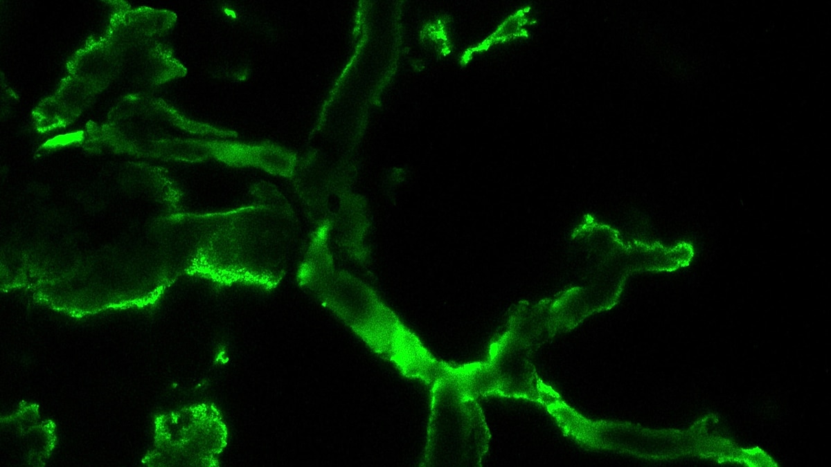 World’s oldest fungi, found in fossils, may rewrite Earth’s history ...