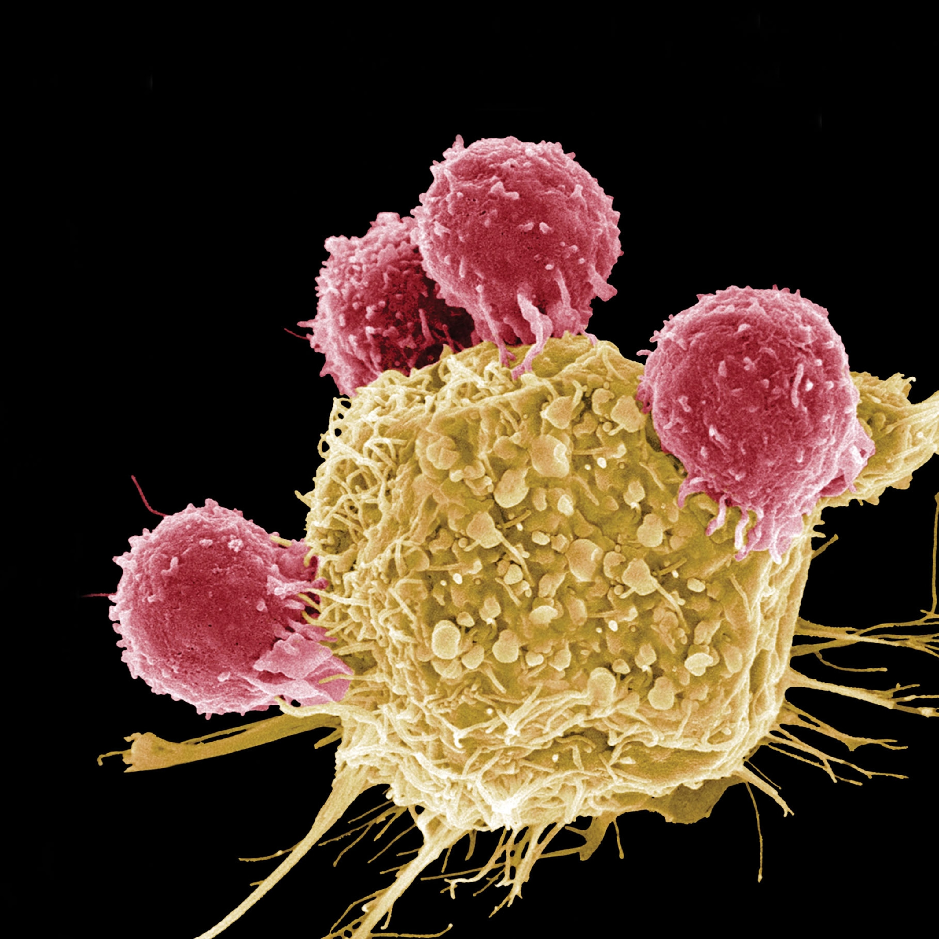 Revving up Resistance to Cancer with Novel Immunotherapies