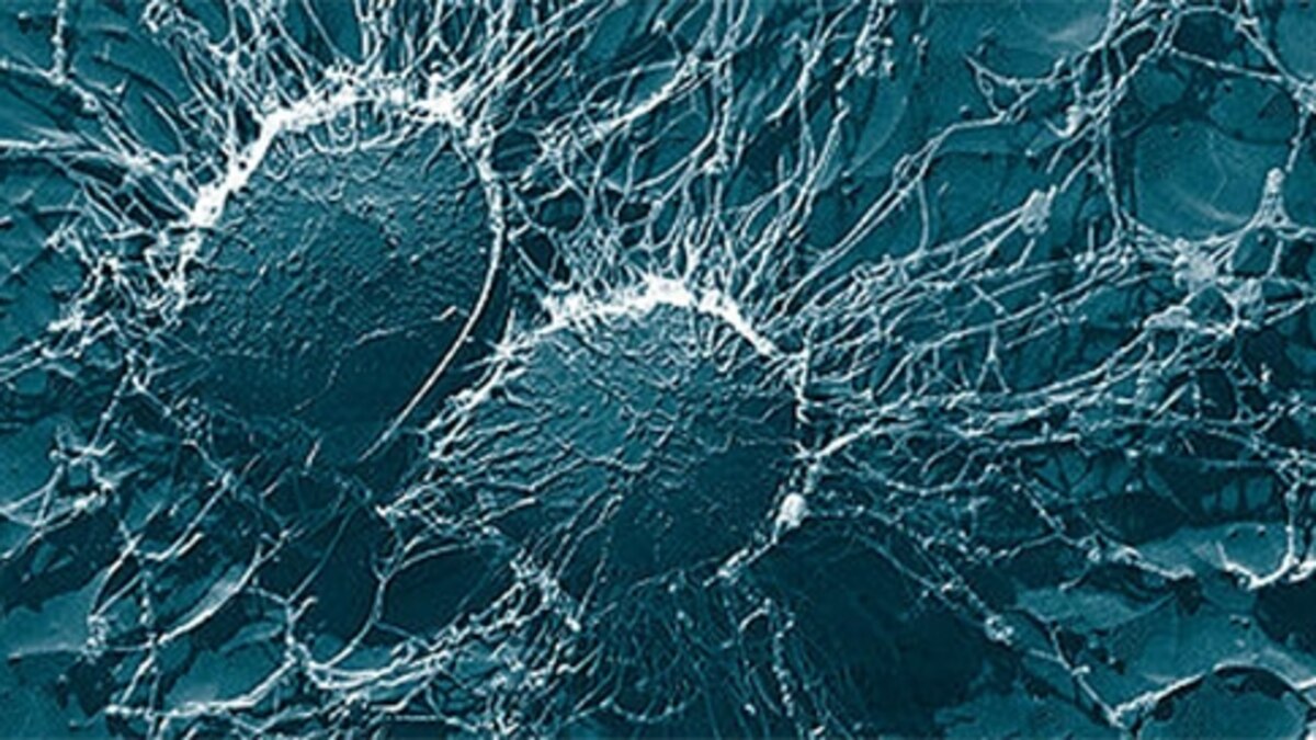 Fighting bacteria with bacteria – common nose germ provides new weapon ...