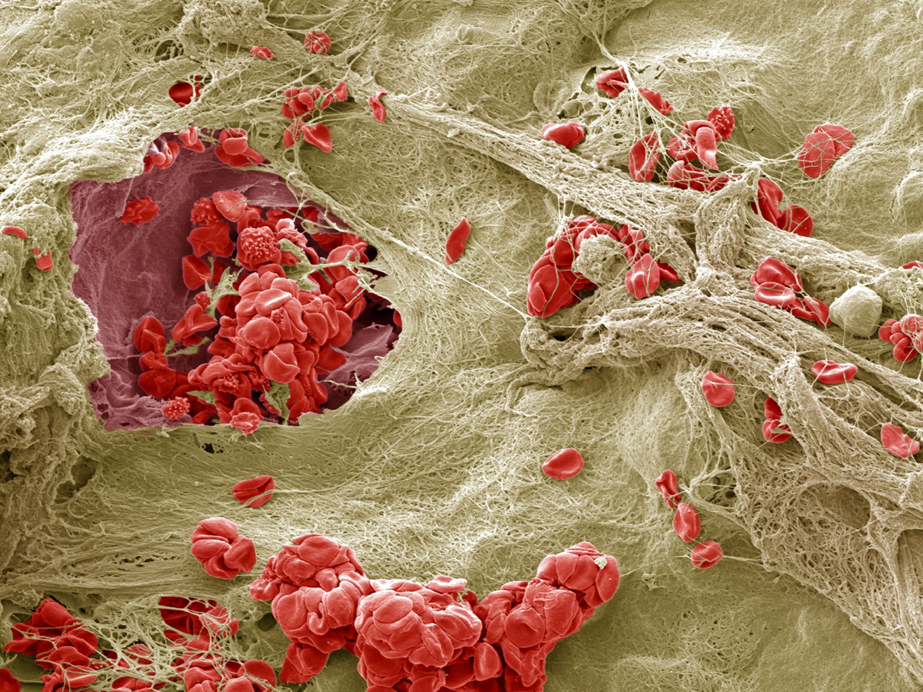 Inflammation isn't always bad. Here's how we can use it to heal.