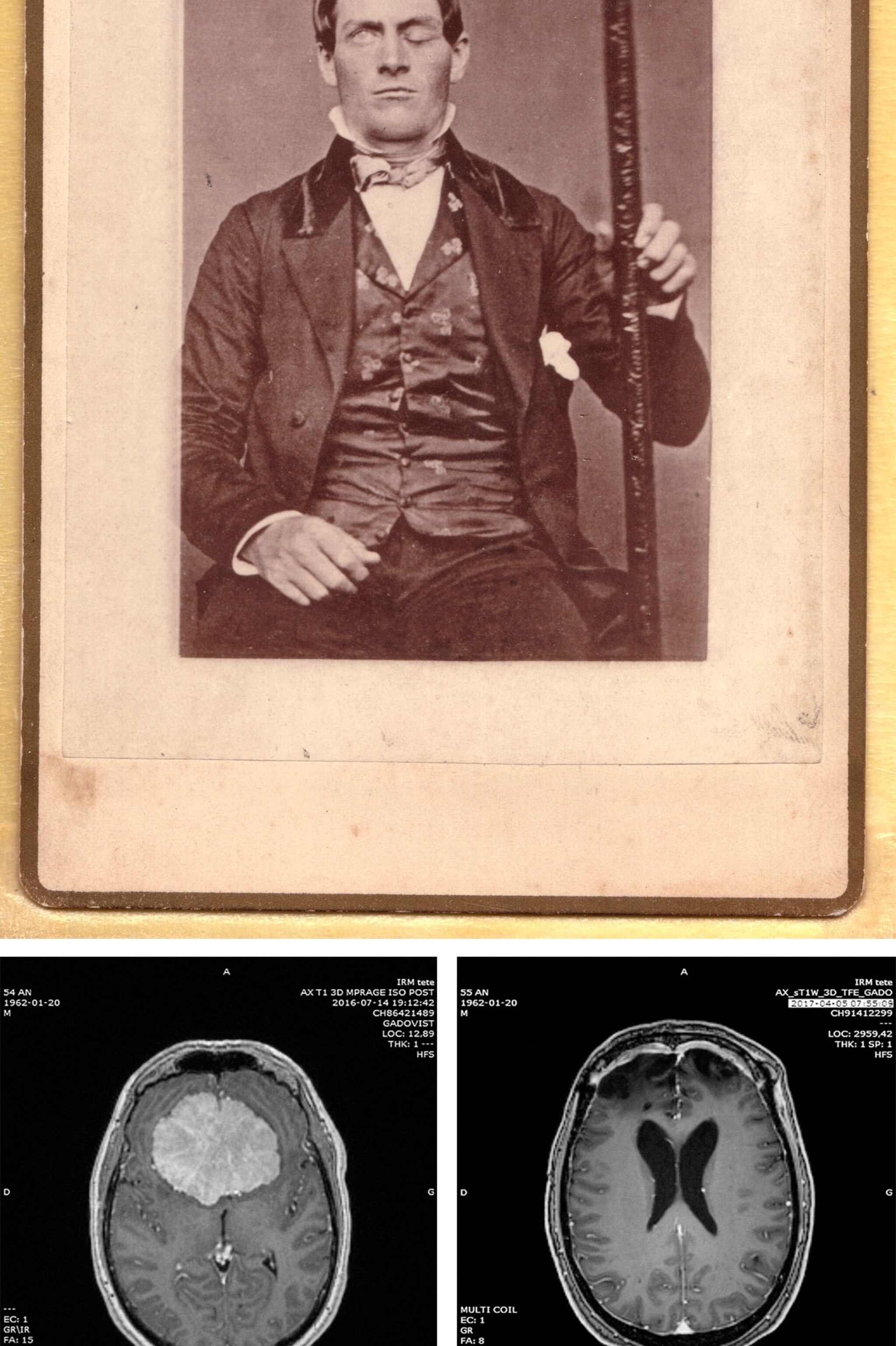 Pittsburgh synagogue shooting: the science of altruism and 'evil'