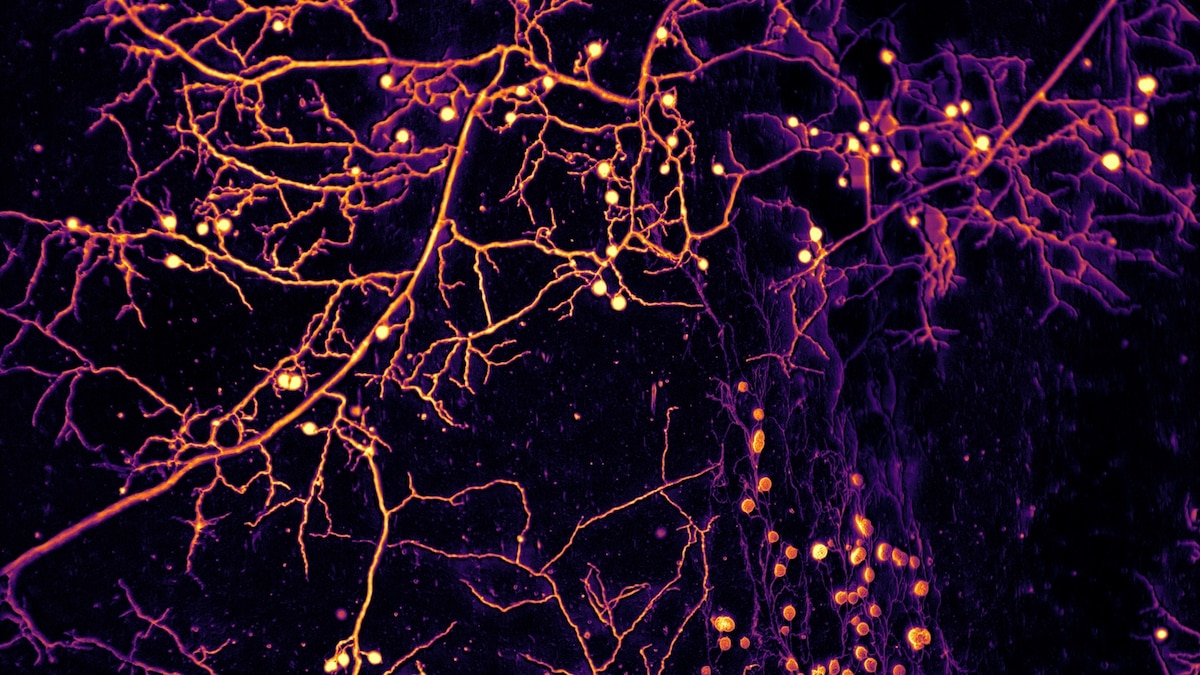 These are the real fungal ‘superhighways’ that inspired ‘The Last of Us ...