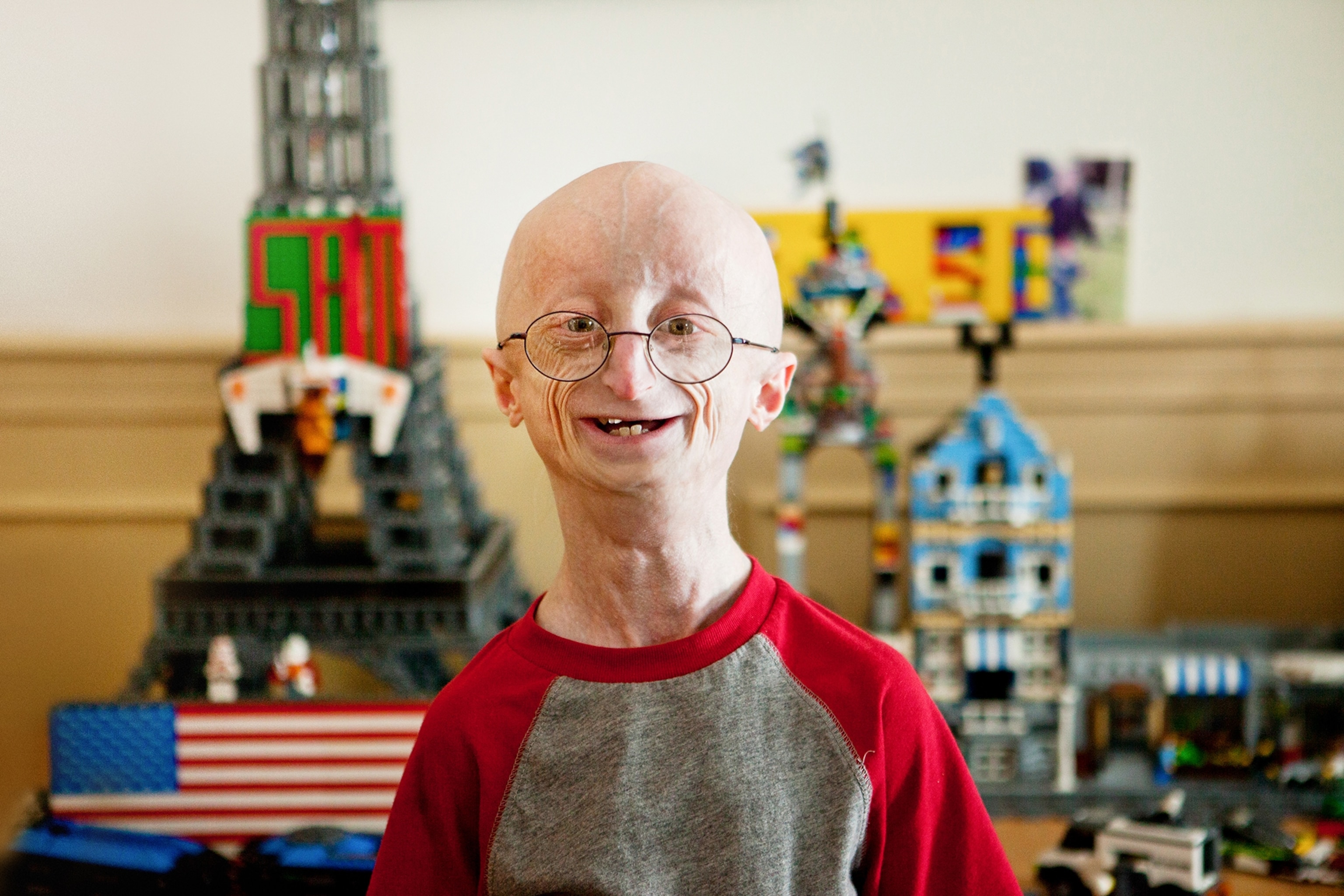 The Short, Remarkable Life of Sam Berns Turned Spotlight on Progeria