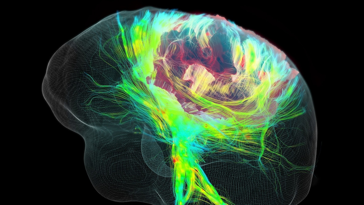 Stopping a tumor's 'cellular looting' may help treatment for brain ...