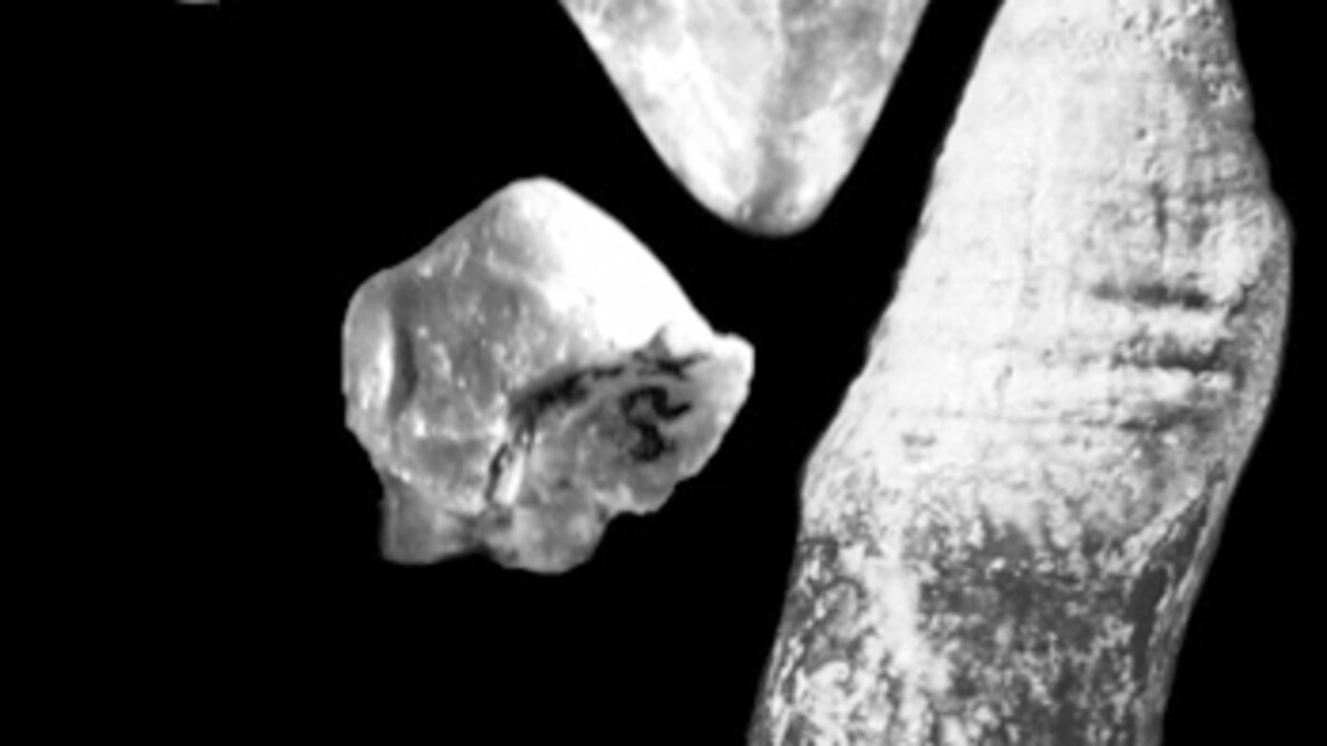 Secrets of the Teeth | National Geographic